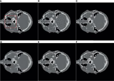 Frontiers | Sparse Angle CBCT Reconstruction Based on Guided Image Filtering